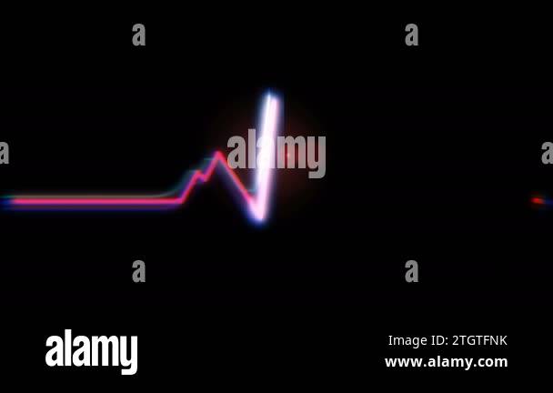Electrocardiogram graph ekg heart rhythm Stock Videos & Footage - HD ...