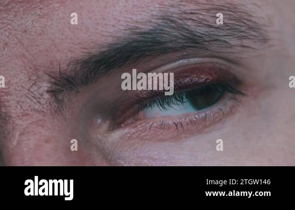 Bruise over the eye of a man, close-up. Young male face with a black ...