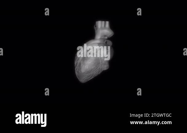 Heart MR X-Ray animation with transparent (alpha) background Stock ...