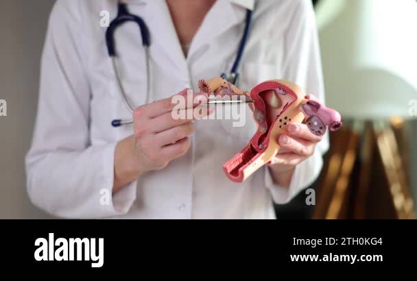 Gynecologist shows anatomical model of uterus and ovaries with ...