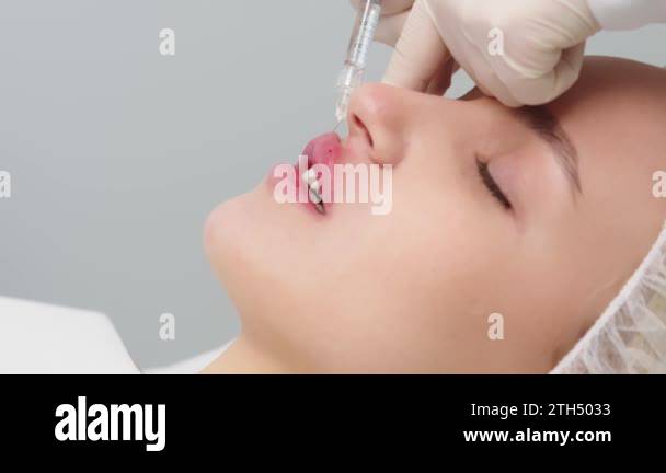 close-up, female lips. Surgeon, in medical gloves, carefully and slowly ...