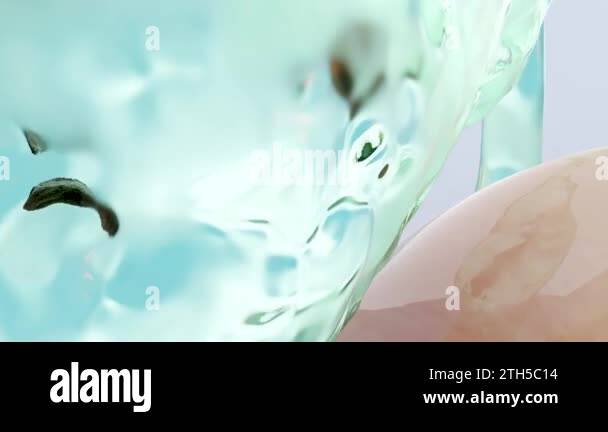 Gallstones in the gallbladderand bile duct, human silhouette and ...