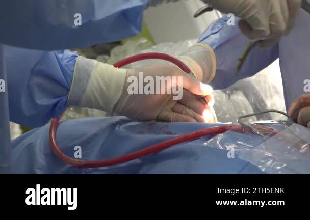 Spinal fusion, also called spondylodesis or spondylosyndesis, is a ...