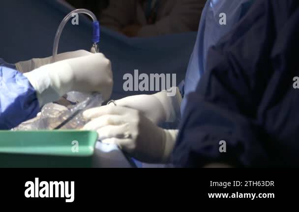 laparoscopic lung surgery Stock Video Footage - Alamy