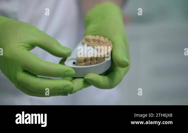 Teeth sample model Stock Videos & Footage - HD and 4K Video Clips - Alamy