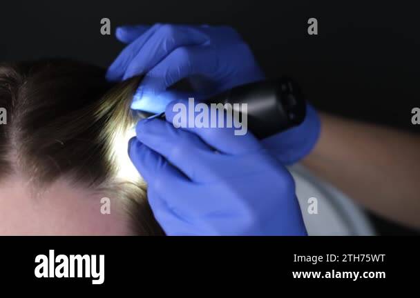 Examination of the scalp Stock Videos & Footage - HD and 4K Video Clips ...