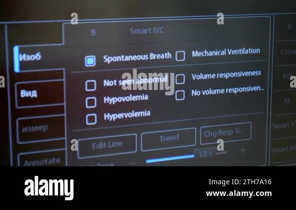 Utrasound image on the monitor close-up. Ultrasound Scan display ...