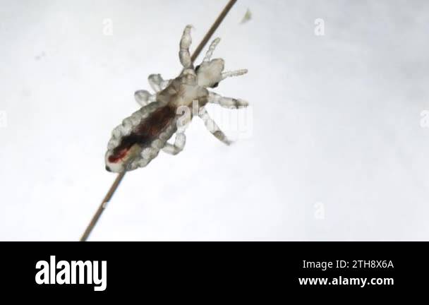 Head louse on a human hair with small head lice walking above her ...
