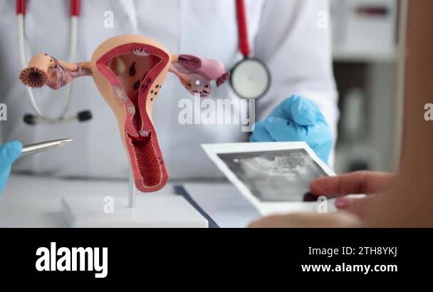 Anatomical model of the female reproductive system, close-up ...