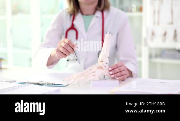Doctor explains operation of foot on bone model. Pain in joints of legs ...