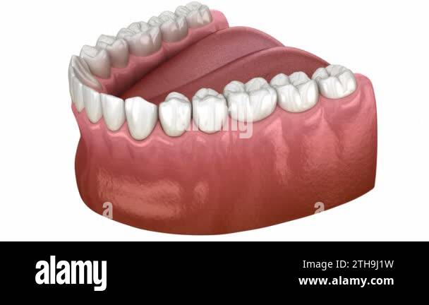 Dental Root anatomy of mandibular human gum and teeth, x-ray view ...