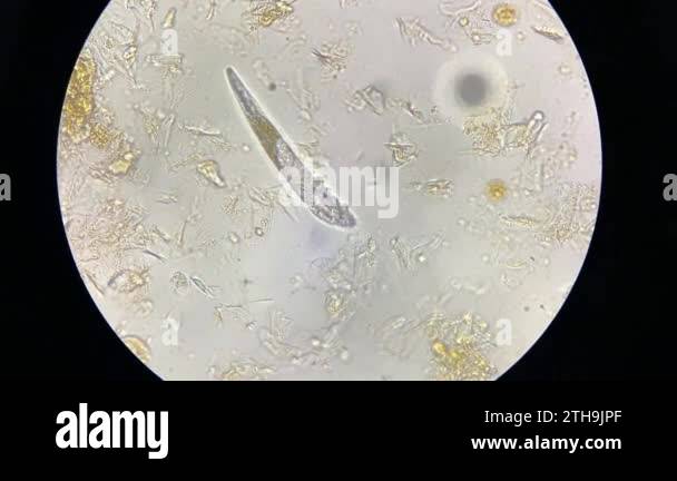 Demodex mange from a microscope view. The parasite causing a skin ...