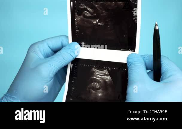 Close-up, Doctor examines in the operating room analyzes the ultrasound ...