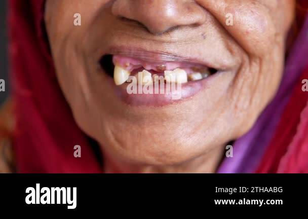 Deformed woman Stock Videos & Footage - HD and 4K Video Clips - Alamy