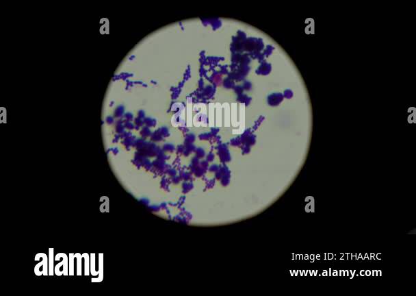Staphylococcus bacteria under the microscope. Sample of anaerobic ...