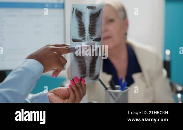 Health specialist explaining x ray scan results to elderly patient ...