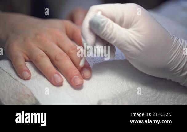 Close-up of a womans hands experiencing nail nursing. A womans visit to ...