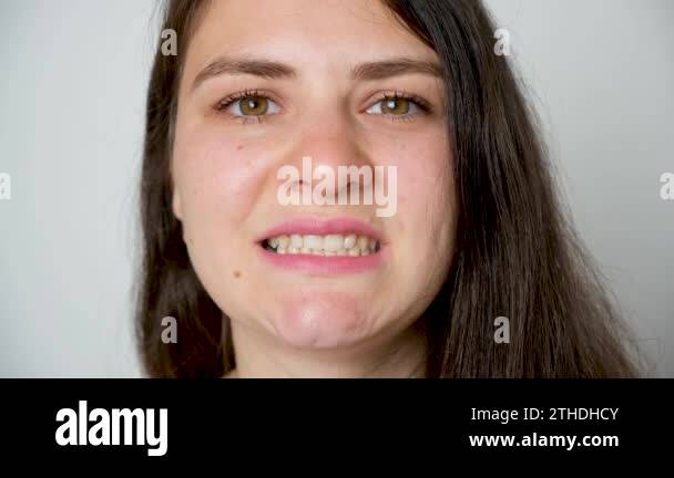 Patient with dislocated jaw and malocclusion, temporomandibular joint ...