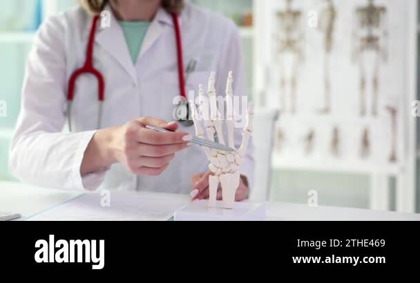 Doctor rheumatologist showing structure of human hand on anatomical ...