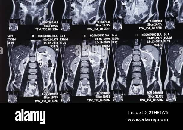X-rays are a type of electromagnetic radiation, just like visible light ...