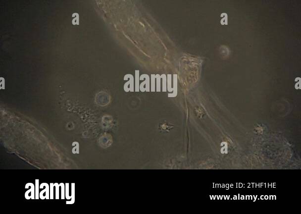Microscopic Vorticella, a tulip-shaped protist, filter feeds using ...
