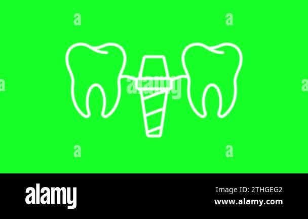 Animated prosthesis white line icon. Endosseous implant. Surgery. Loop ...