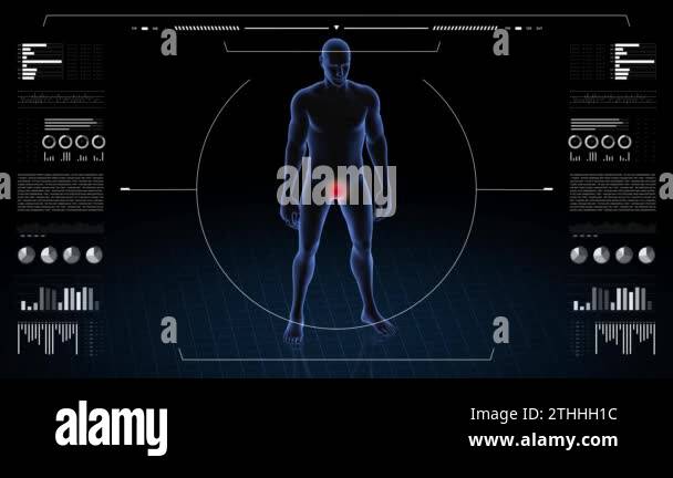 Man with genital pathology. 3d body of boy. Rotating animation and ...