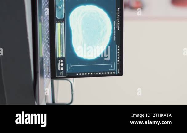 Vertical video: Laptop showing neural system on desk in medical ...
