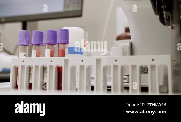 Blood Test Machine with tubes. Blood Testing Machine Checks Samples ...
