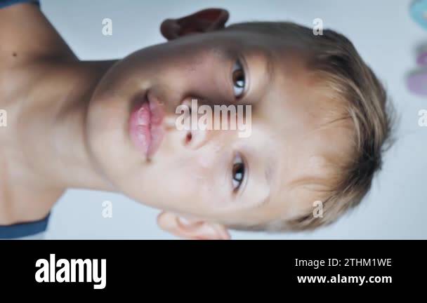 scratching his nose with a finger with the symptom of atopic dermatitis ...