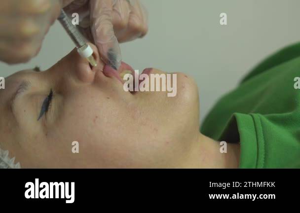 Lip injection procedure. Plastic surgery. Lip contouring procedure ...