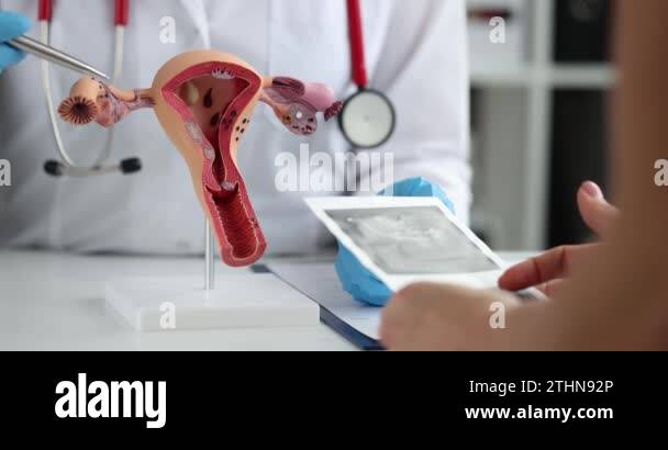 Examination of woman health of uterus and ovaries. Gynecology female ...