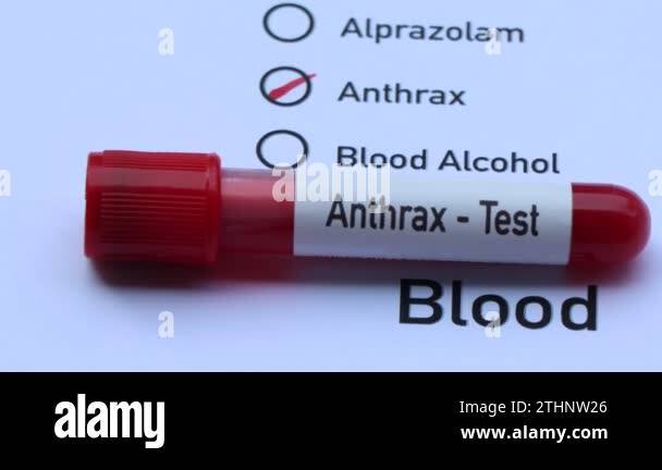 Anthrax test to look for abnormalities from blood, blood sample to ...