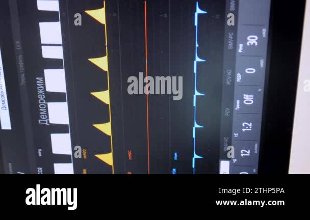 Modern patient monitor. Electronic Health Monitor displaying medical ...