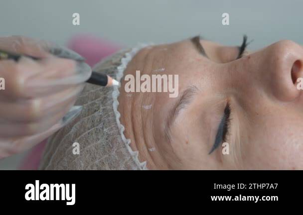 Facial injection procedure. Plastic surgery. Blockage of facial muscles ...