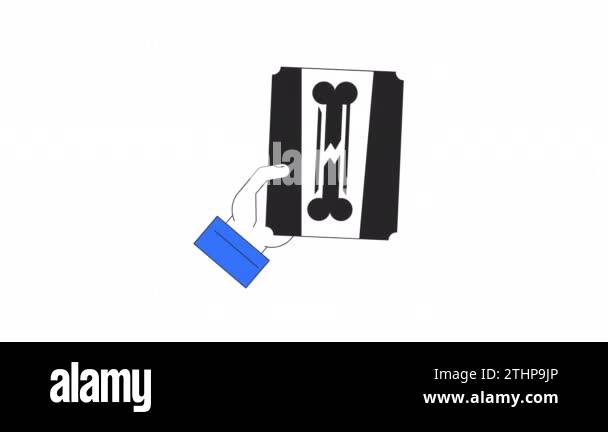 Holding bone x ray scan animation. Orthopedic trauma isolated 2D ...