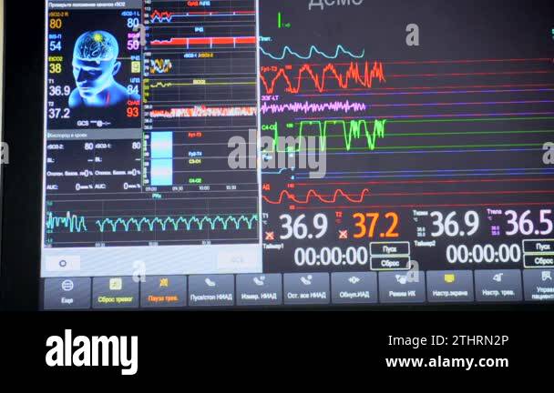 Modern patient monitor. Electronic Health Monitor displaying medical ...