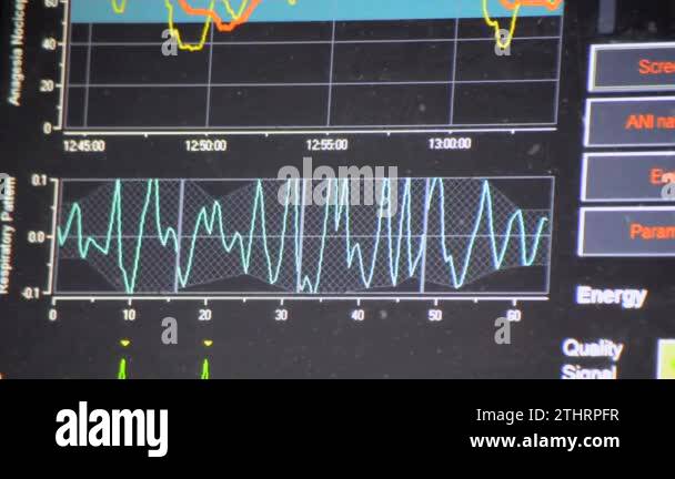 Modern patient monitor. Electronic Health Monitor displaying medical ...