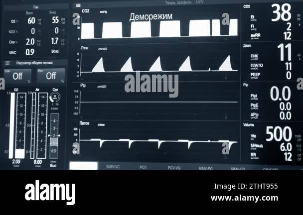 Patient monitor close-up. Monitor with different patient vital signs in ...