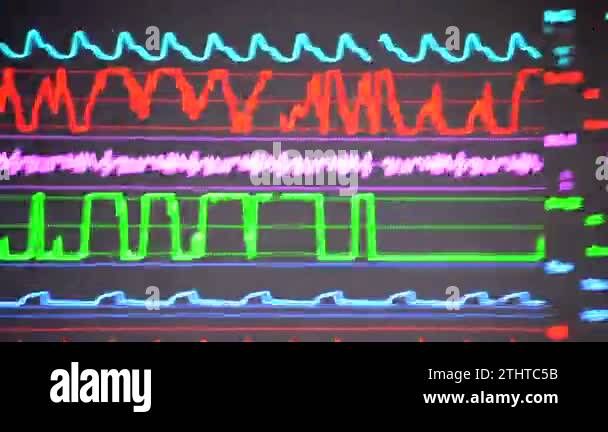 Modern patient monitor. Electronic Health Monitor displaying medical ...
