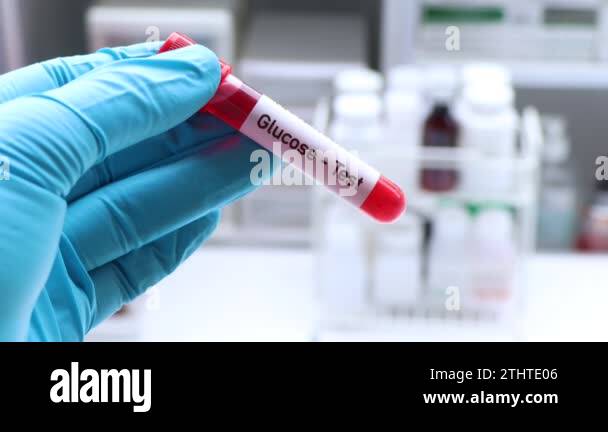 Glucose test to look for abnormalities from blood, blood sample to ...