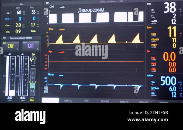 Modern patient monitor. Electronic Health Monitor displaying medical ...
