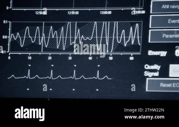 Modern patient monitor. Electronic Health Monitor displaying medical ...
