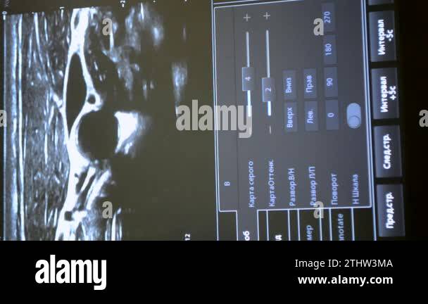 Ultra sonogram Stock Videos & Footage - HD and 4K Video Clips - Alamy