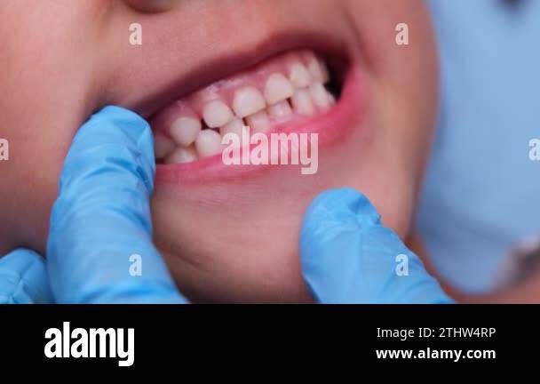 Close-up inside the oral cavity of a healthy child with beautiful rows ...