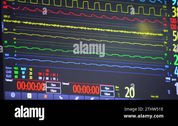 Modern patient monitor. Electronic Health Monitor displaying medical ...