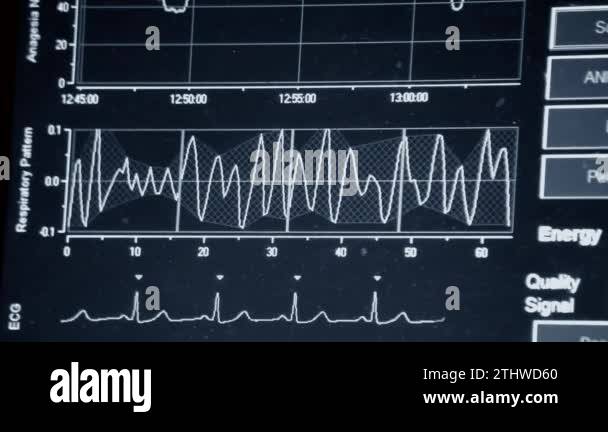 Modern patient monitor. Electronic Health Monitor displaying medical ...