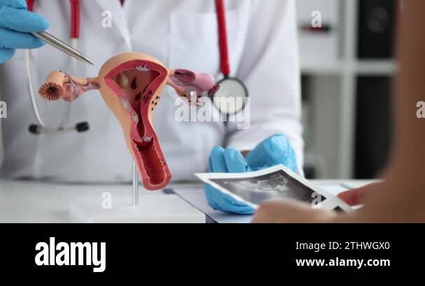 Gynecologist demonstrates model of female reproductive system to woman ...