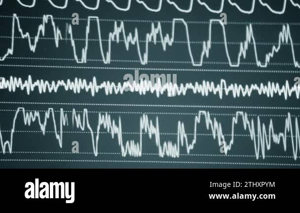Modern patient monitor. Electronic Health Monitor displaying medical ...