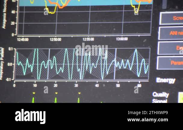 Modern patient monitor. Electronic Health Monitor displaying medical ...